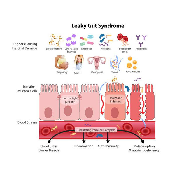 Gut and Health - Volstad Integrated Wellness - Palm Beach Gardens FL